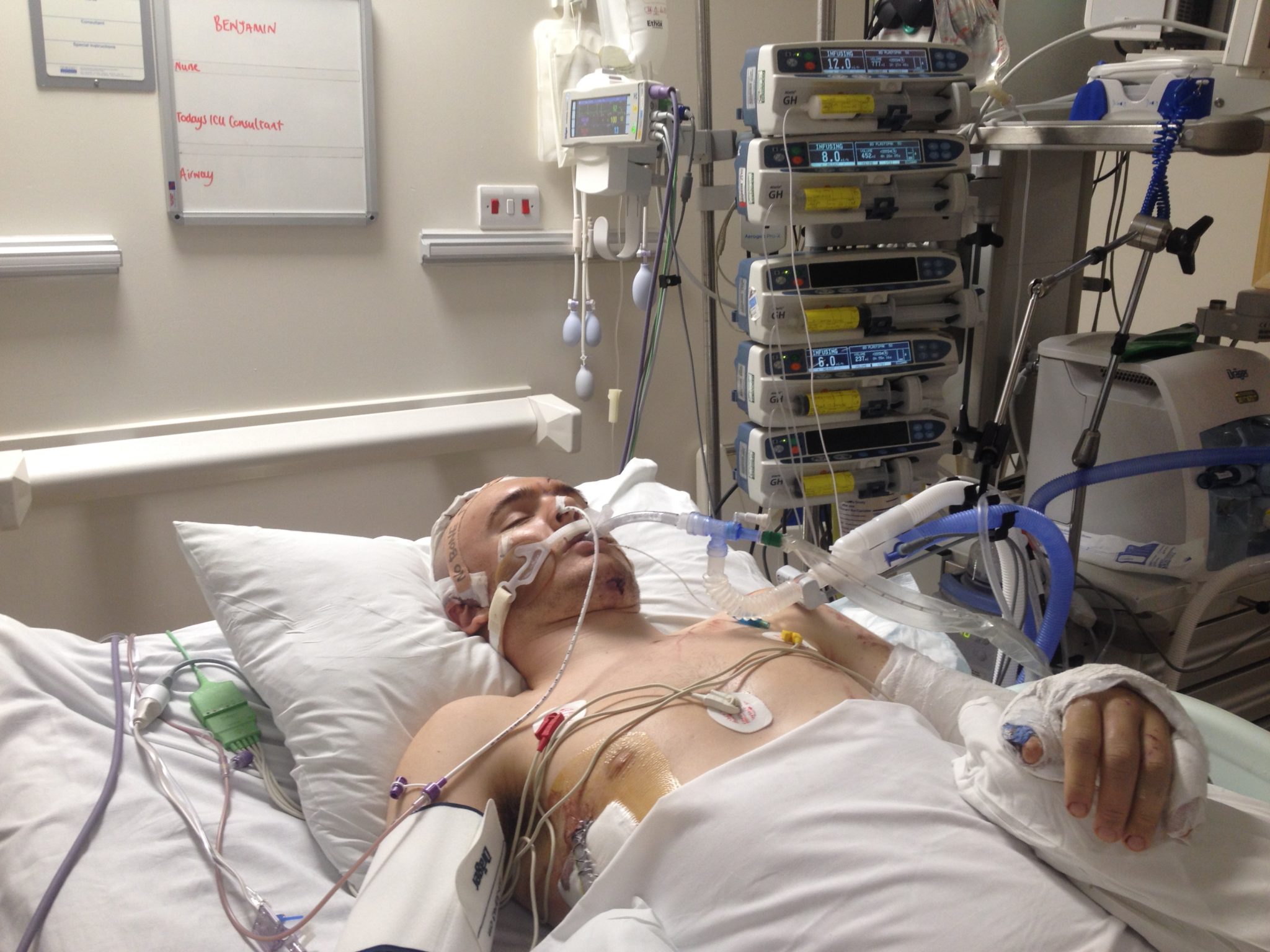 Cyclist who suffered brain injury aims for Paralympic glory - Great ...